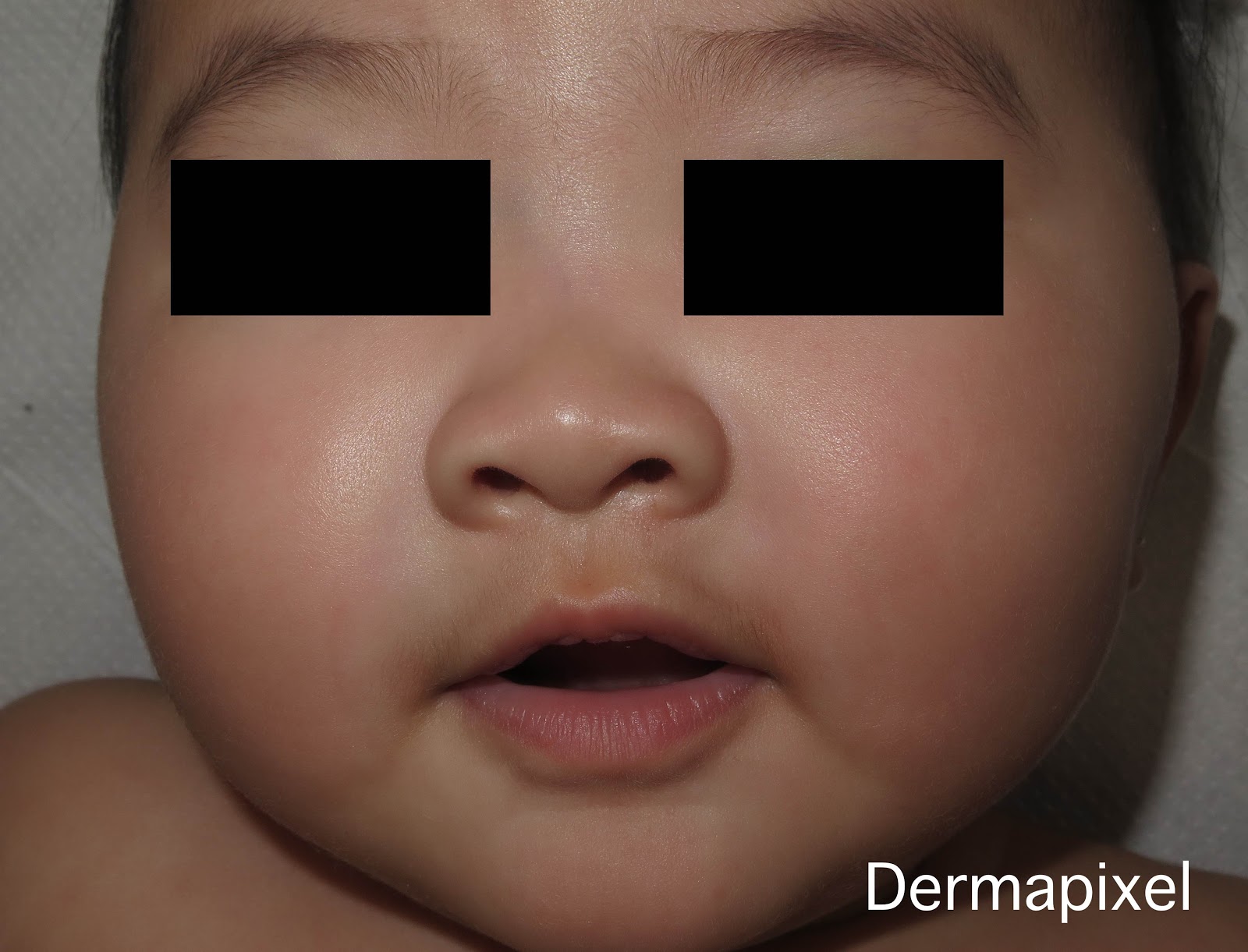 Dermapixel: mayo 2020