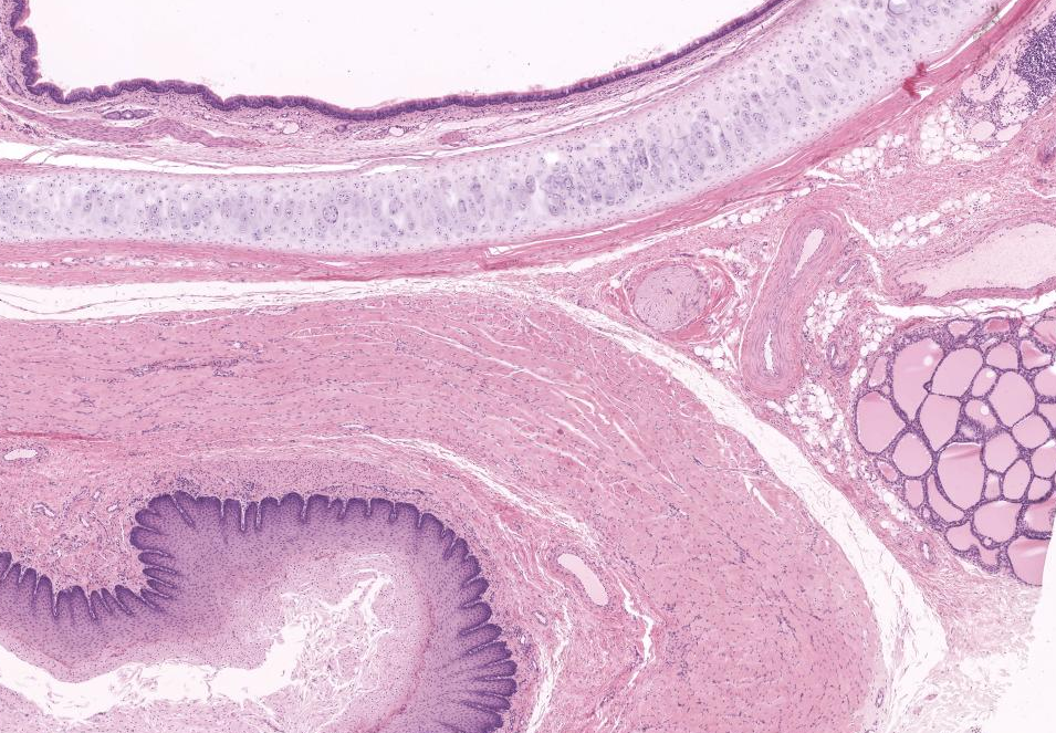 μicroscopia: TRACHEA, ESOFAGO E TIROIDE