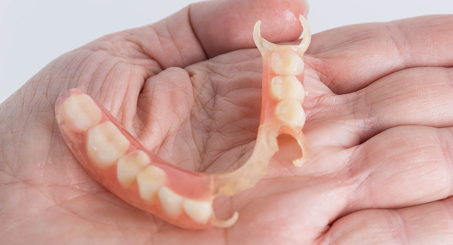 Prótese Parcial Flexível - Descubra TUDO Sobre Este Tratamento: O Que é ...