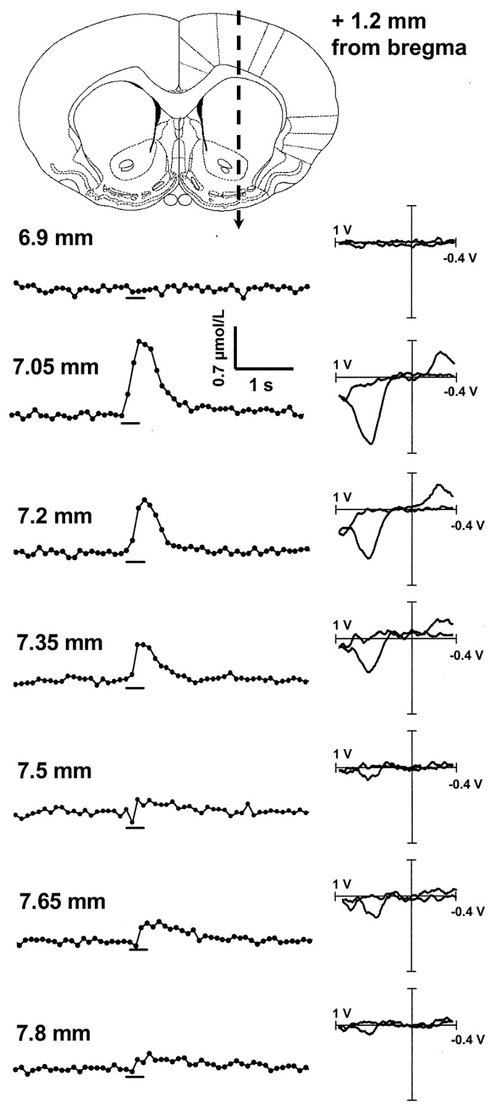 The Neurocritic: November 2013