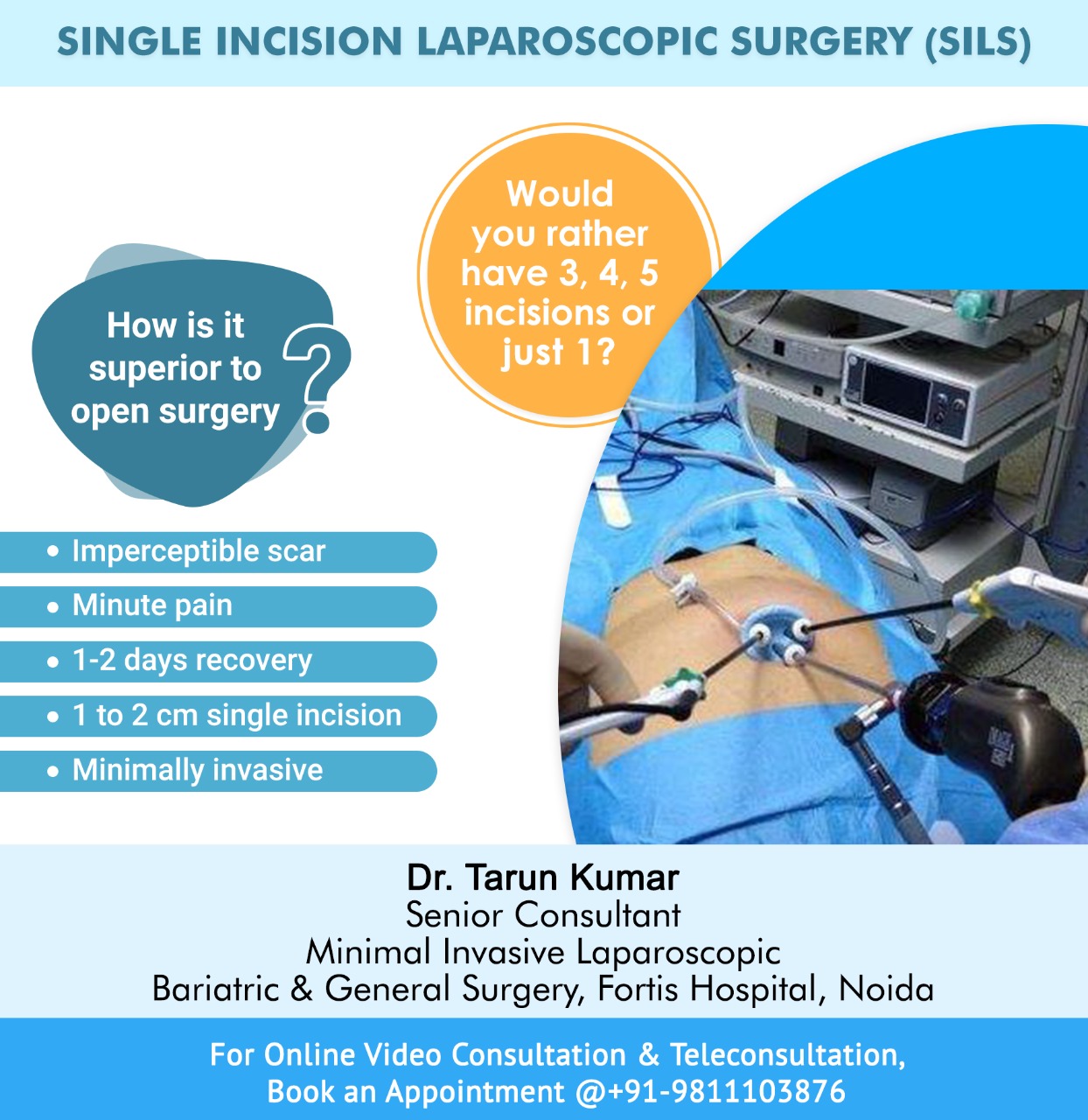 Dr. Tarun Kumar Surgeon: Single Incision Laparoscopic Surgery (SILS)