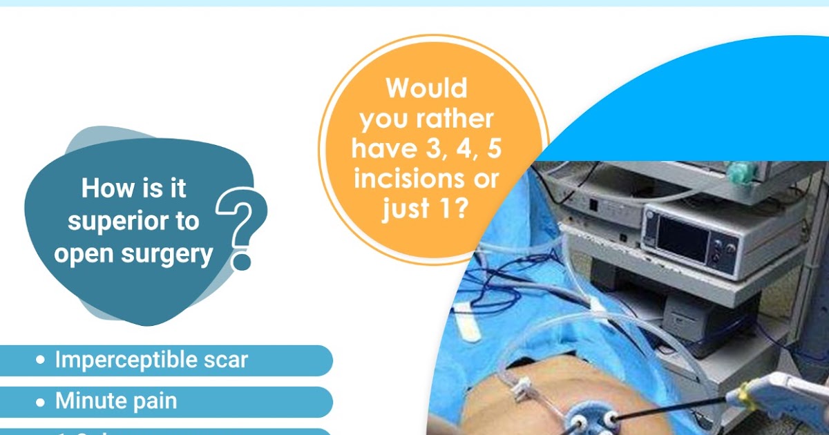 Dr. Tarun Kumar Surgeon: Single Incision Laparoscopic Surgery (SILS)