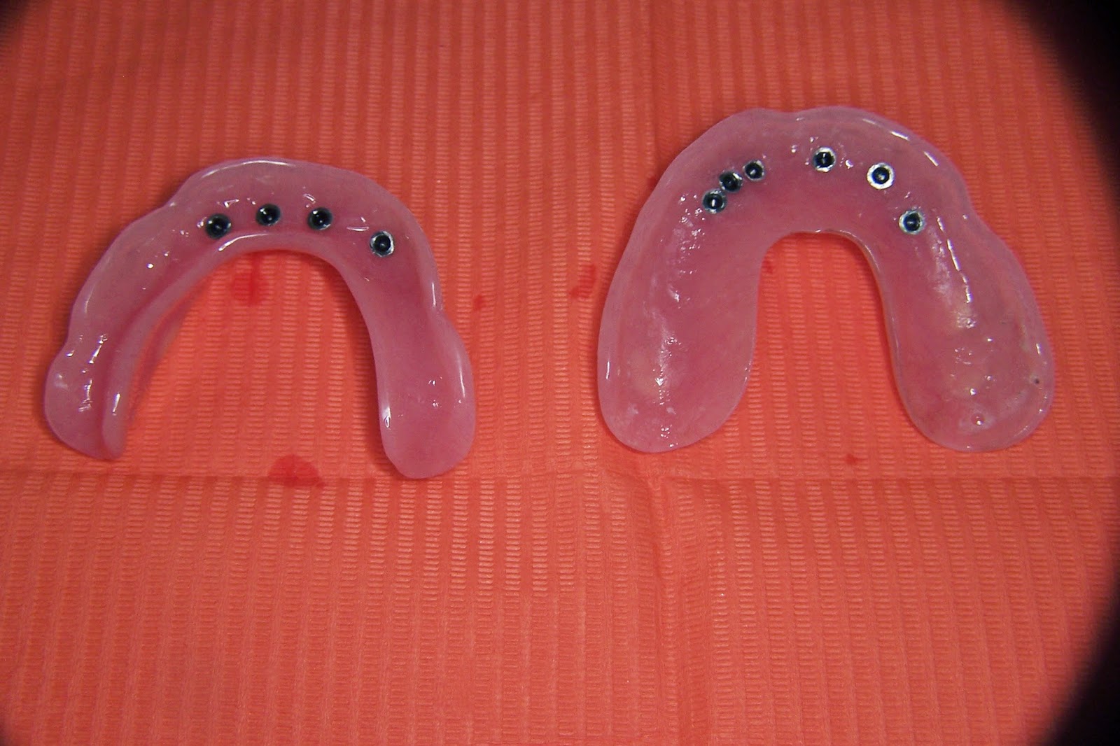 Blog del Dr. Lopez de Calatayud Gaio: Mini implantes dentales ...
