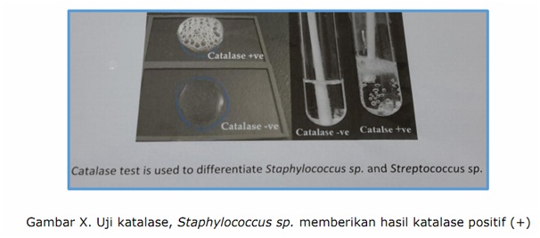 Aprelea Noni: Staphylococcus aureus