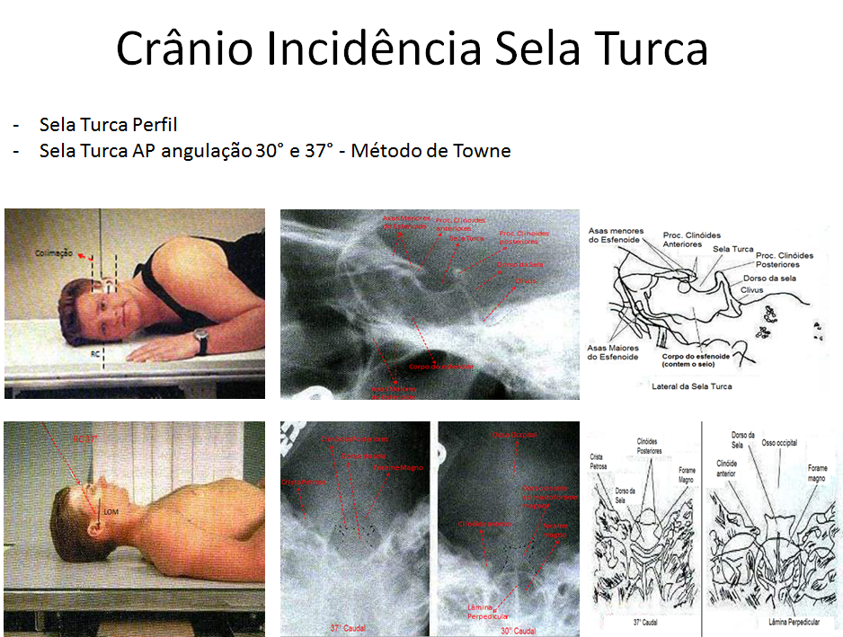 Laboratório de Roentgen: Crânio e Face