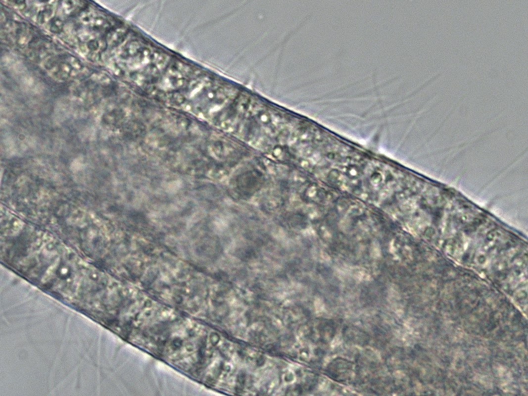 Invertebrate Embryology: Planula of Proboscidactyla flavicirrata