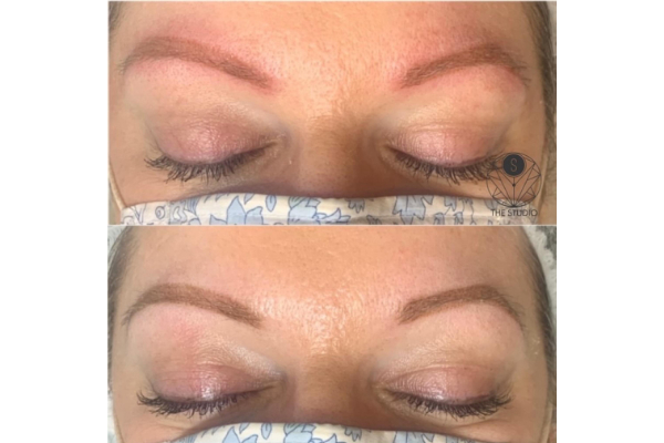 Arthurwears: Semi-Permanent Eyebrow Healing Journey | Emergency Removal
