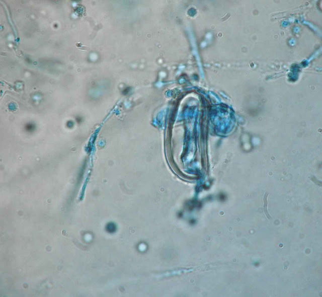ATLAS MICOLOGIA: ASPERGILLUS USTUS COMPLEXO