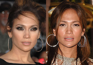 Jennifer Lopez Surgery