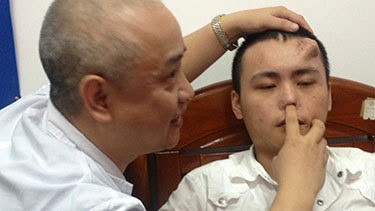 Man grows nose on his forehead - Papua New Guinea Today