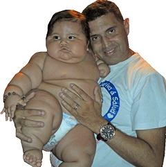 Gbigs Angle: World's Fattest Baby Rescued