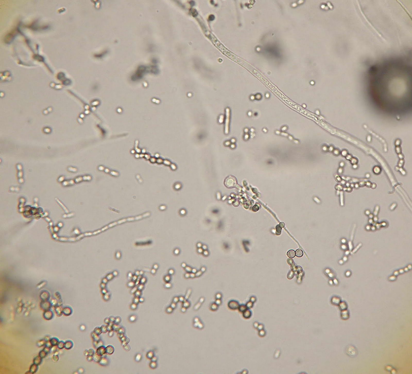 ATLAS MICOLOGIA: SCYTALIDIUM DIMIDIATUM (Neoscytalidium dimidiatum)