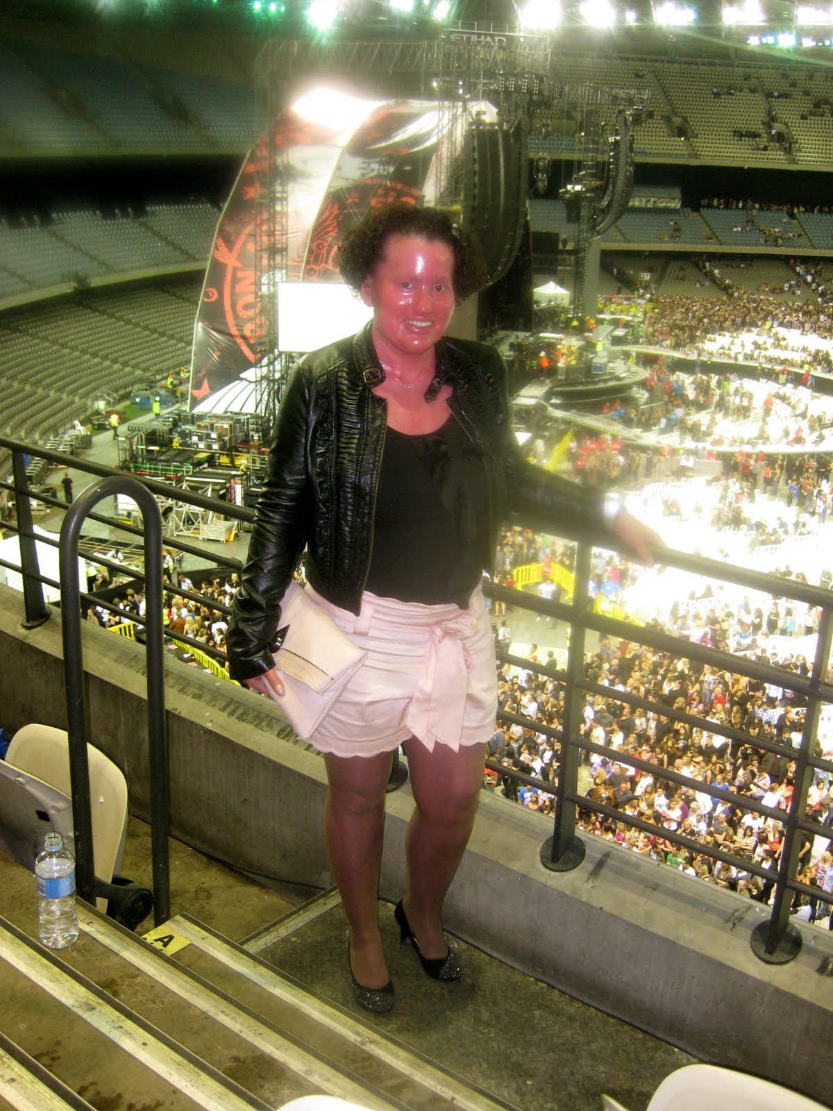 About me - Carly Findlay