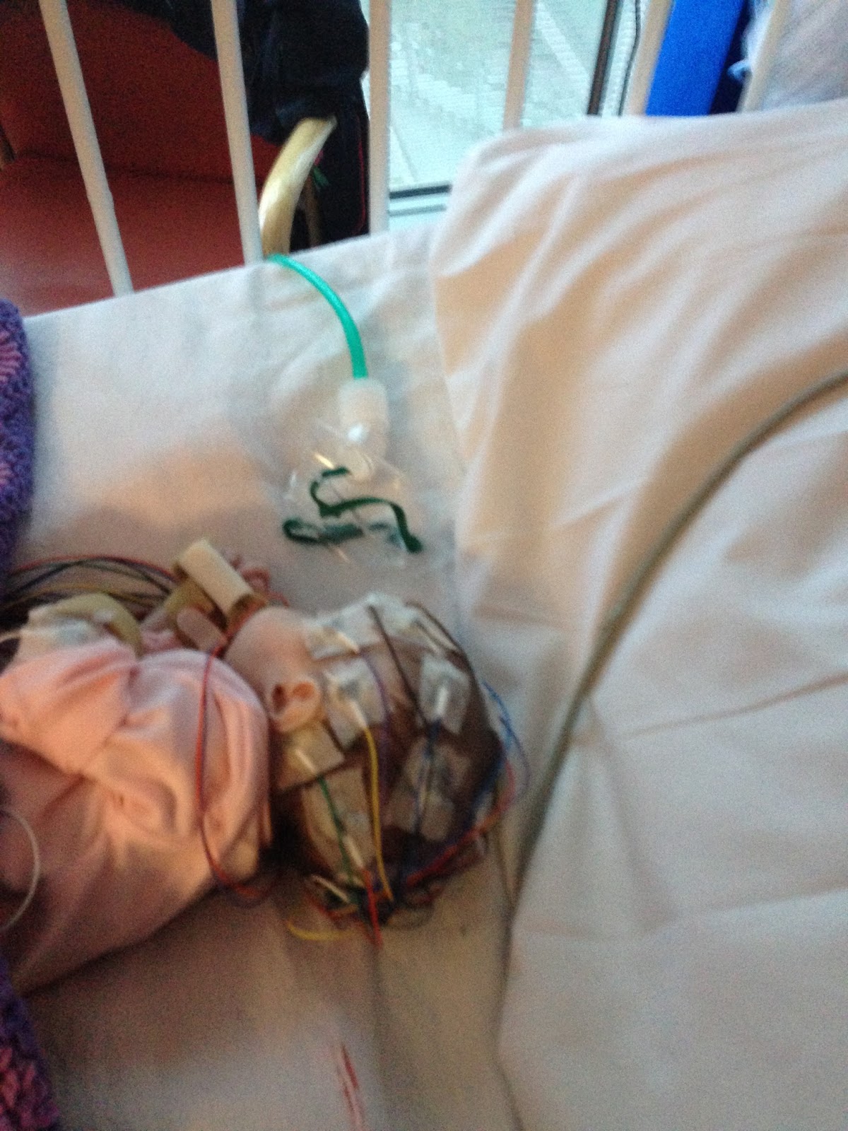 Nobody dies of trisomy 18... | Rumer's Rainbow