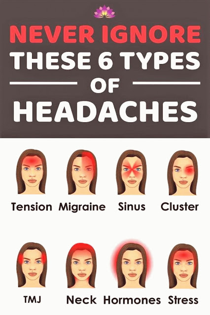Never Ignore These 6 Types of Headaches - wellness magazine