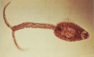 Mobilização Social Distrito Sanitário de Itapuã: Esquistossomose ...