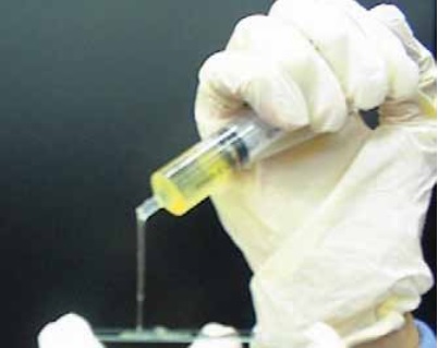 [Haematology] Atlas of Synovial Fluid | Free Medical Atlas