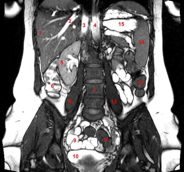Tecnicos Radiologos: La Enterografía RM puede reemplazar la ...