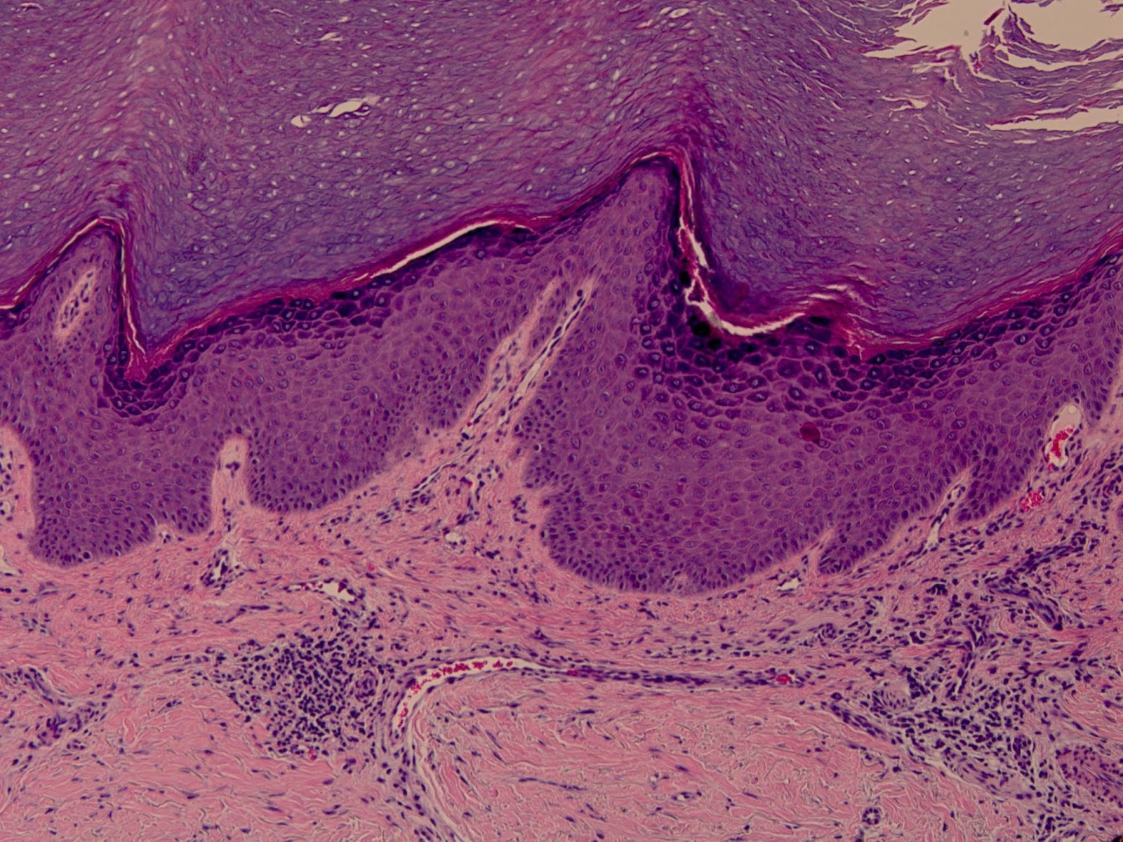 EL RINCÓN DE LA MEDICINA INTERNA. juanpedromacaluso@yahoo.com.ar ...