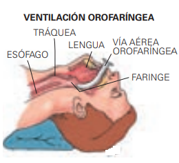 Ventilación artificial | El Blog De La Enfermera