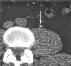 ABC Radiology Blog: 10/01/2013 - 11/01/2013