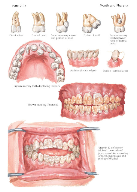 Dental Abnormalities - pediagenosis