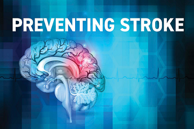 7 steps to prevent Stroke
