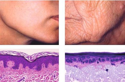 THE NURSING IN THE CARE OF THE ELDERLY: THE INTEGUMENTARY SYSTEM.