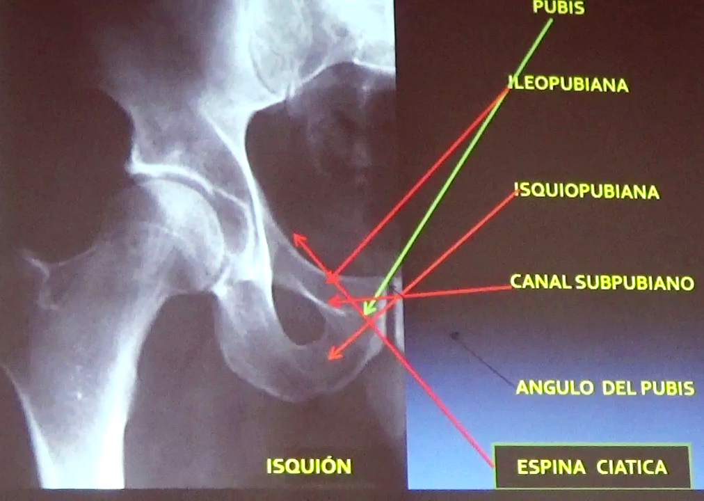 RADIOANATOMIA: septima clase