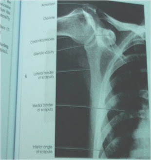 Catatan Ku: Teknik Radiografi Scapula