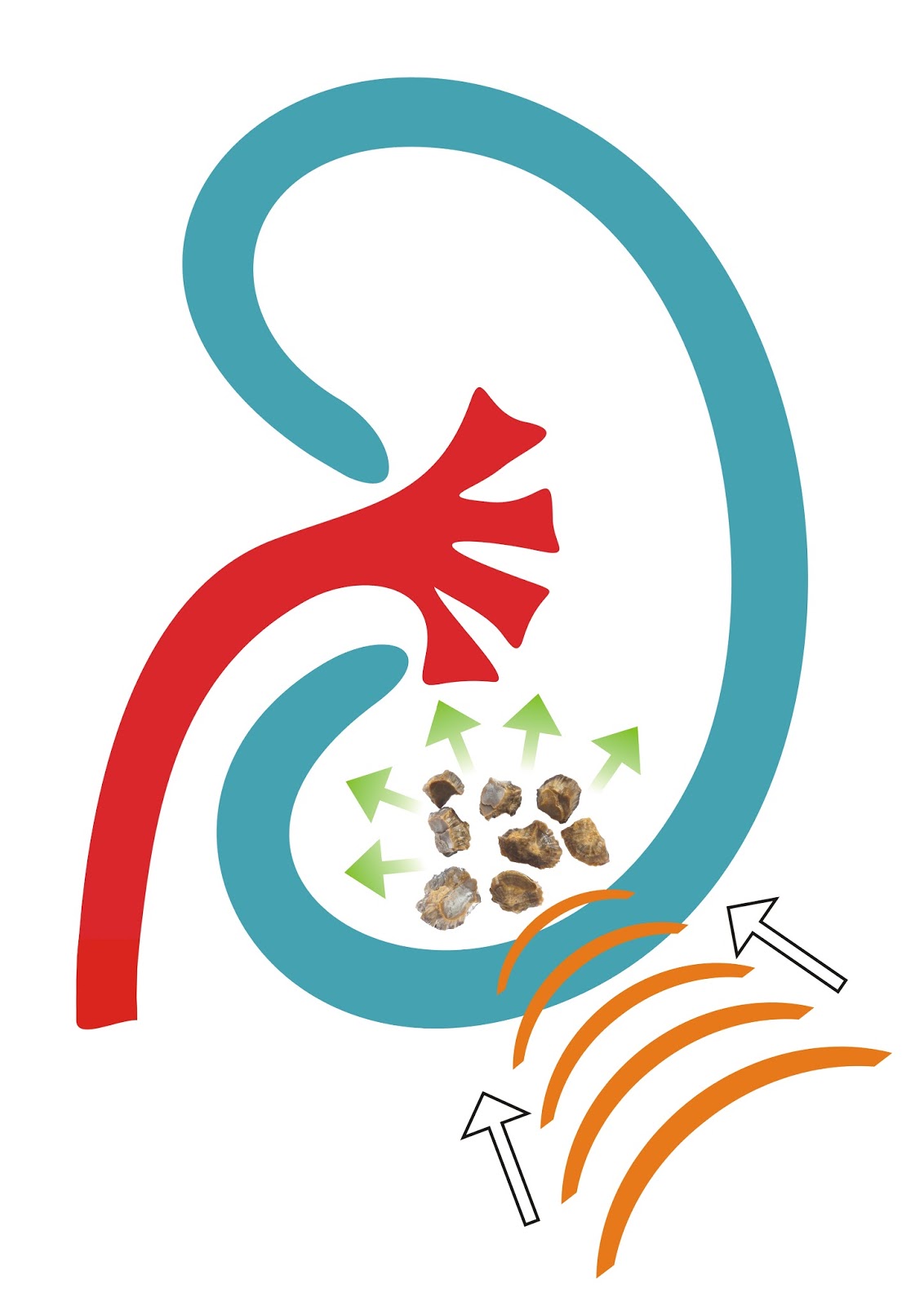 Kidney & Urostone Centre - Multi-Speciality Hospital Chandigarh, India ...