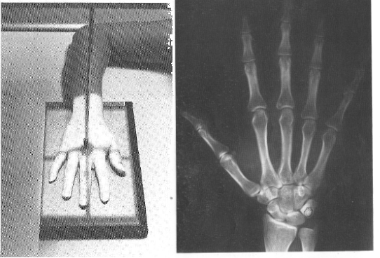 Radiologia: imagenologia 2
