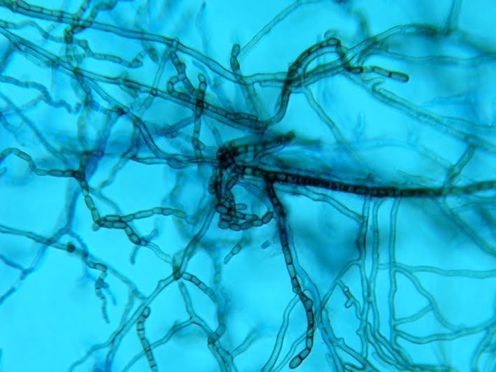 Fun With Microbiology (What's Buggin' You?): Neoscytalidium dimidiatum