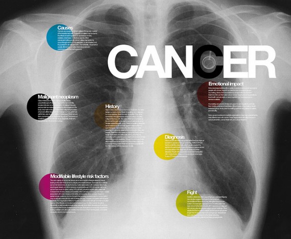 Cancer Detail Care: Is Cancer a Disease