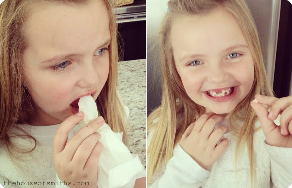 7 Steps to remove a Child's Loose Tooth - Healthy Dental ~ Family ...