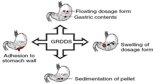 Gastro-retentive drug delivery systems