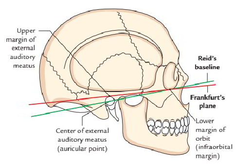 easyhumanatomy: Frankfurt’s plane