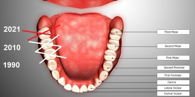 ApacheDug's Teepee: Losing my teeth and dealing with a touch of ageism ...