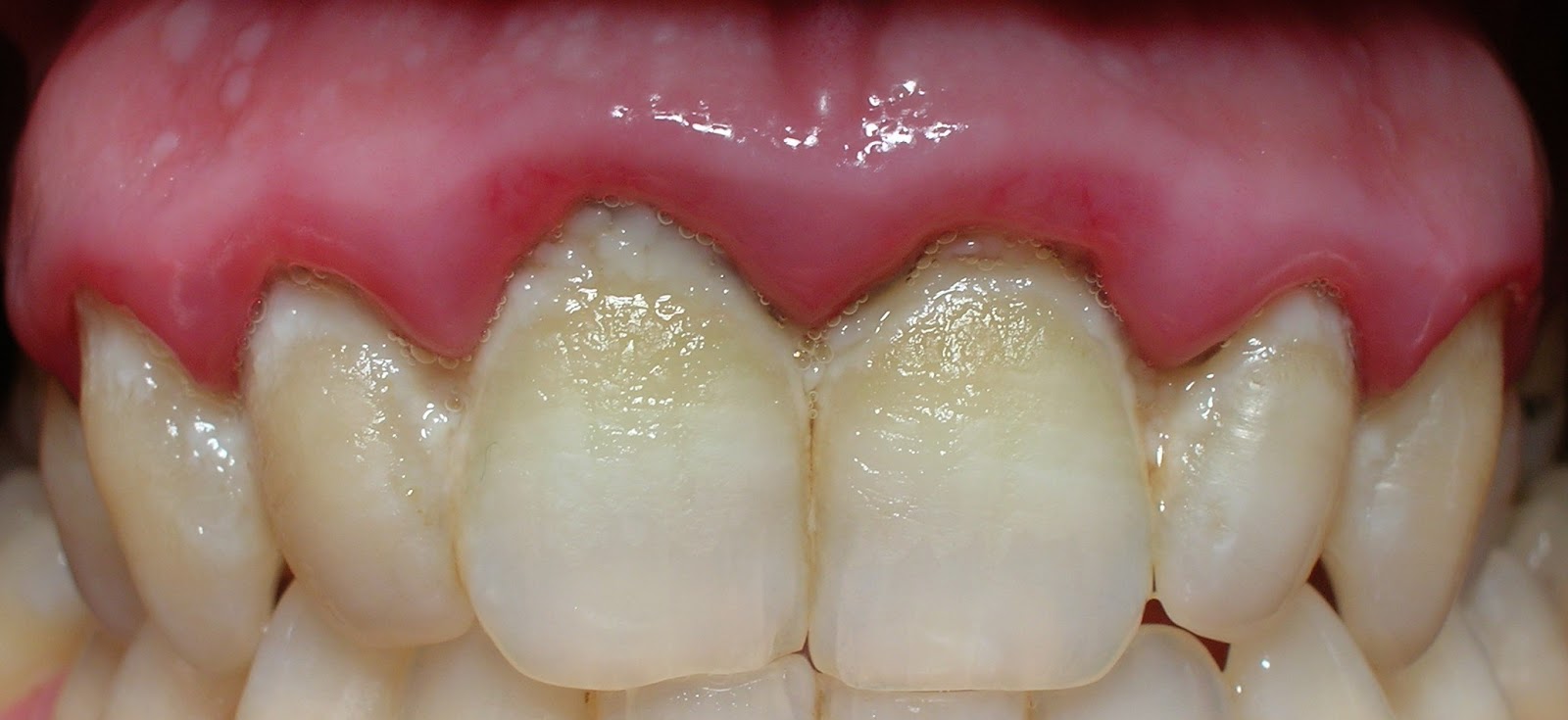 SEMINARIO DE SALUD ORAL