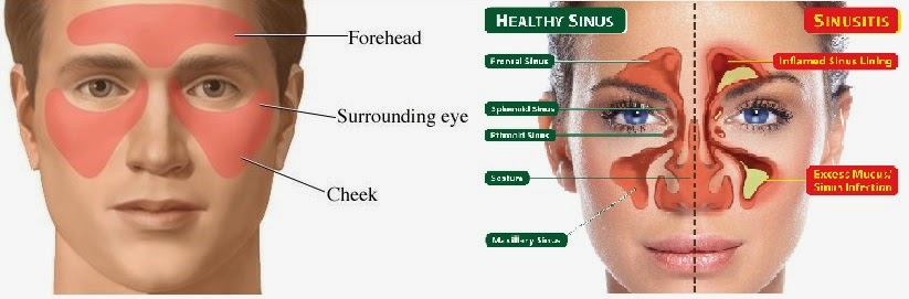 Relieving Headache with DermAureas Bio-electro Stimulation Therapy ...