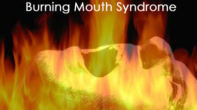 Educational Dentistry by - Dr. David Dersh!: Burning Mouth Syndrome