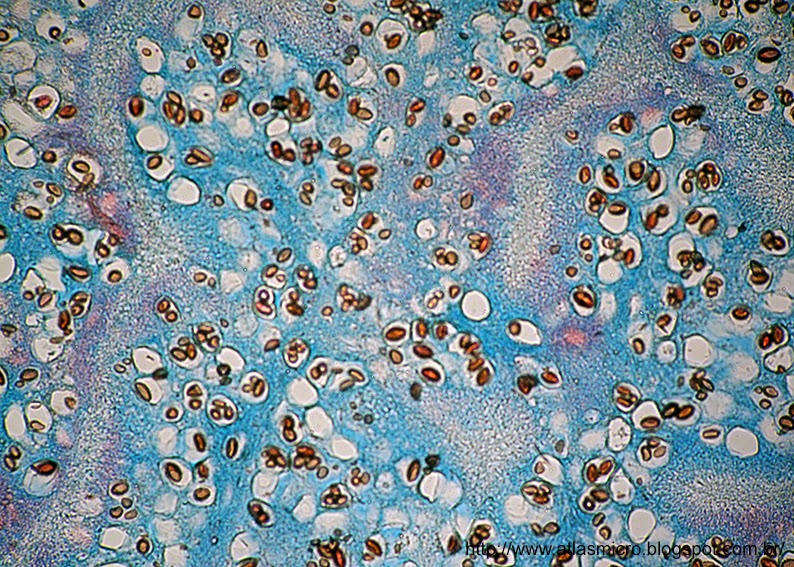 Atlas de Microbiologia: Fungos