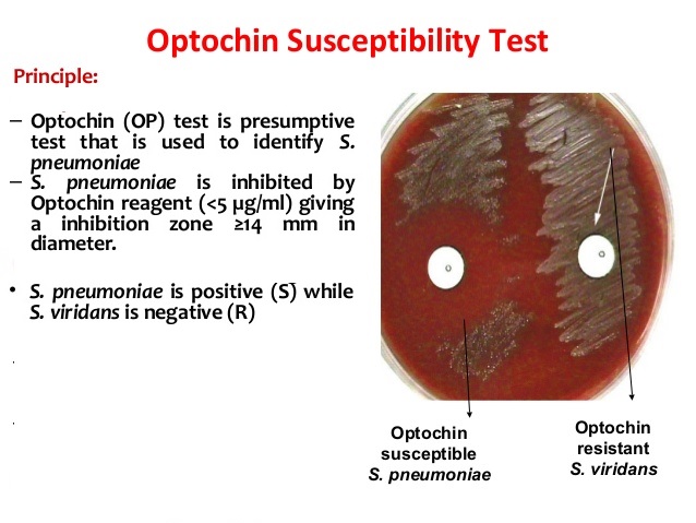 Merlins Micro World: S.pneumoniae - Antigens, Biochemical Reactions ...