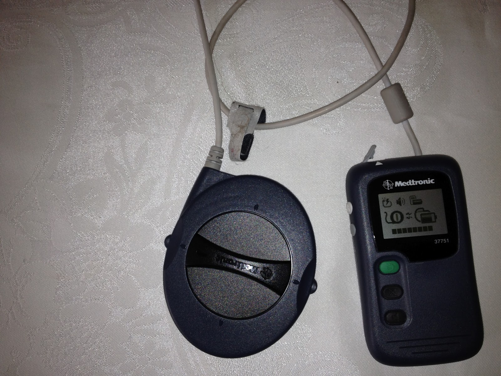 DBS; A different Journey to what I am used to: The DBS Rechargeable Battery