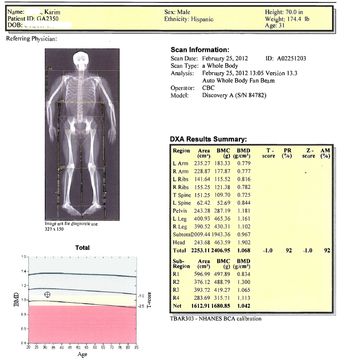 Karim's Health and Fitness Blog: Body Fat Measuring with a DXA (DEXA) Scan