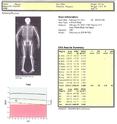 Karim's Health and Fitness Blog: Body Fat Measuring with a DXA (DEXA) Scan