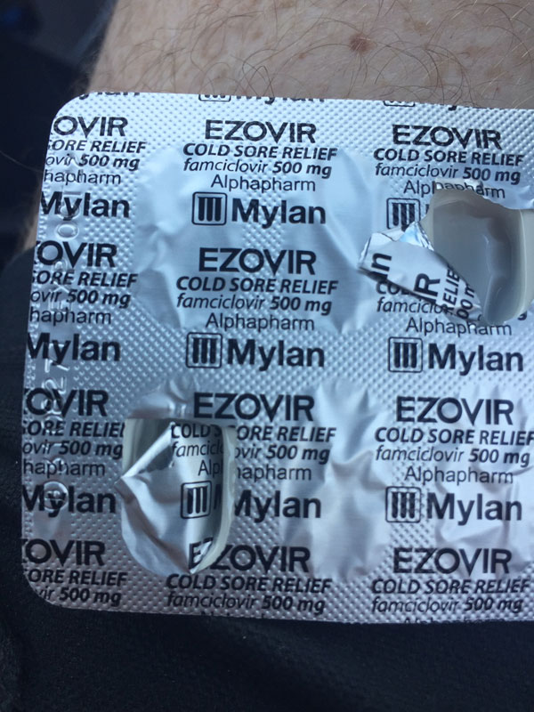 みんな違ってあたりまえ: ミラクル口唇ヘルペス治療薬