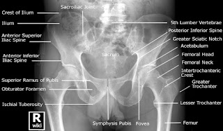 TEKNIK RADIOGRAFI PELVIS - Radiografer