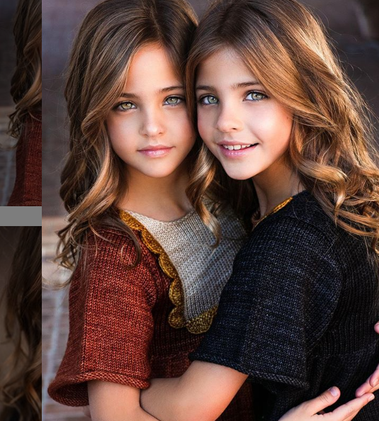 GÊMEAS MAIS BONITAS DO MUNDO