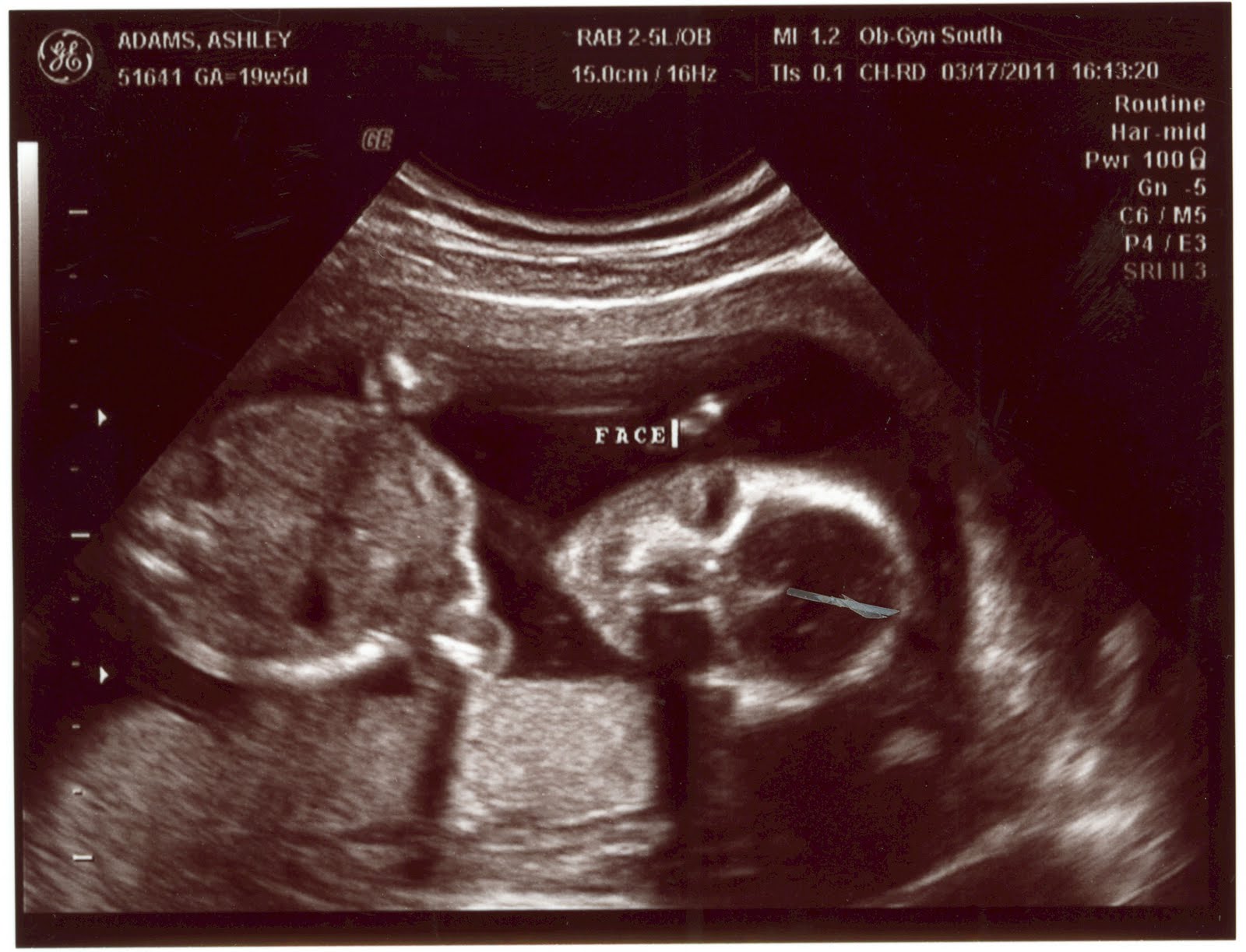 All The Fun Of Baby Number One Our 20 Week Ultrasound Pictures all-the-fun-of-baby-number-one-our-20-week-ultrasound-pictures